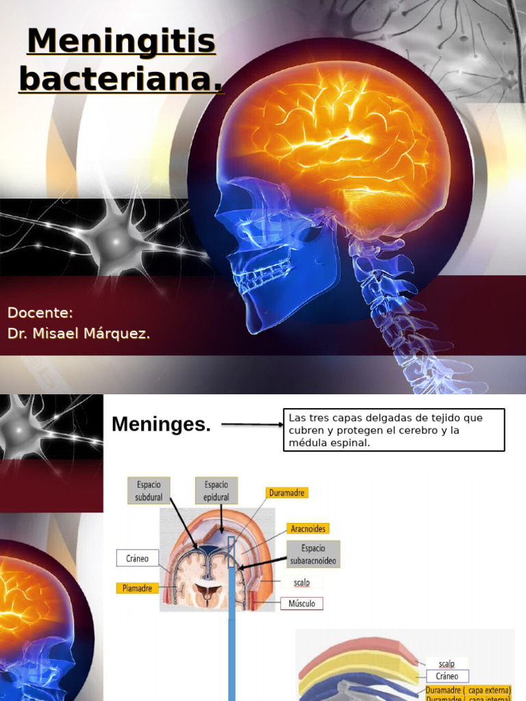 Meningitis Neonatal | PDF | Meningitis | Fluido cerebroespinal