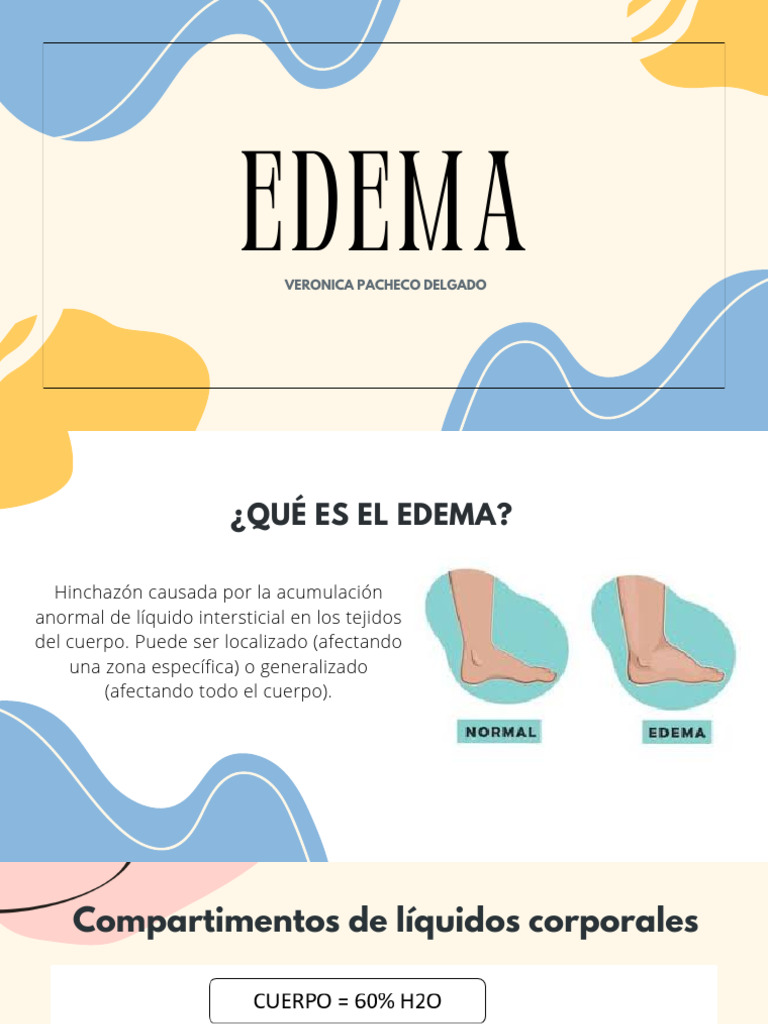 Causas y tipos de edema en el cuerpo | PDF | Edema | Especialidades Medicas