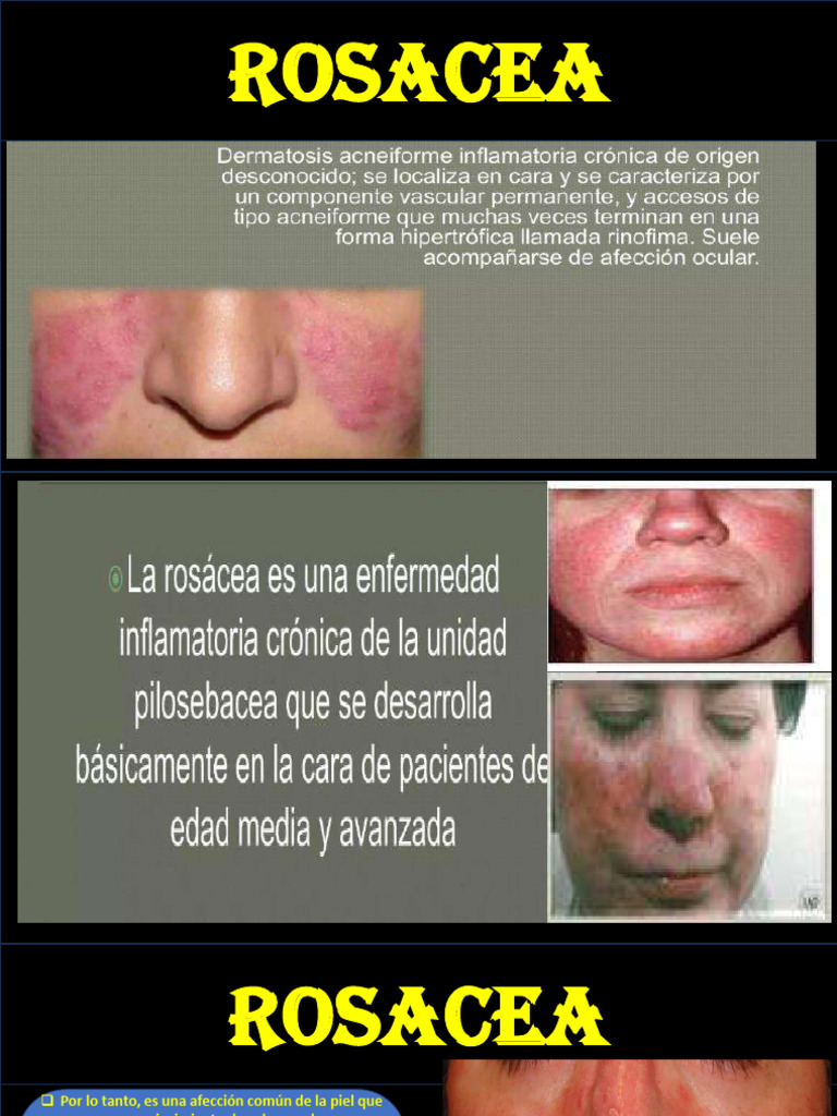 Dermato Teoria 3 Parcial | PDF | Alergia | Condiciones cutáneas