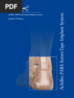 Acumed ES Surgical Technique Fibula Nail 2 ESFNA10 02 A | PDF