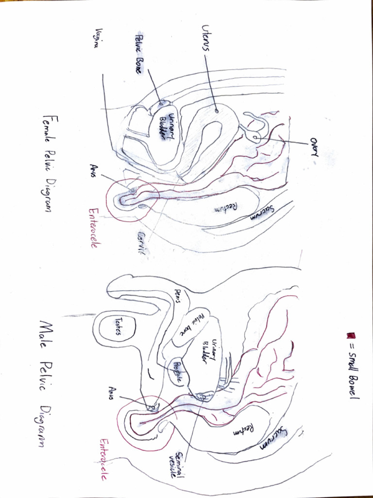 Enterocele Sketch Diagram (3) | PDF