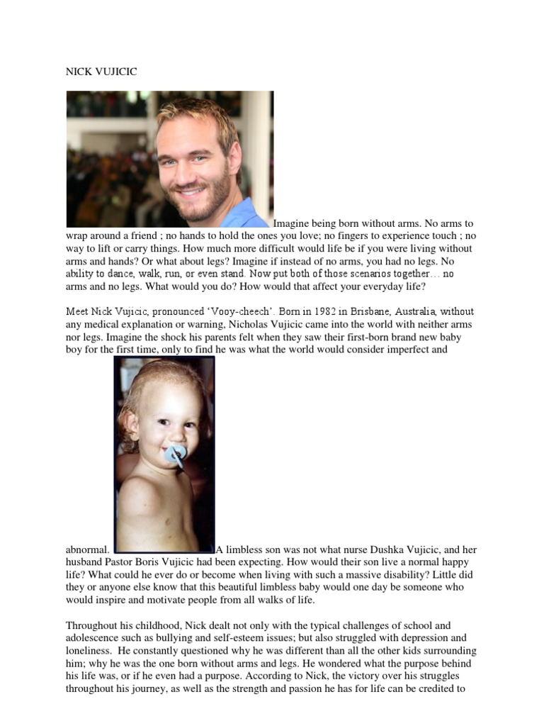 The Astonishing Story Of Nick Vujicic Born Without Limbs Who Lives