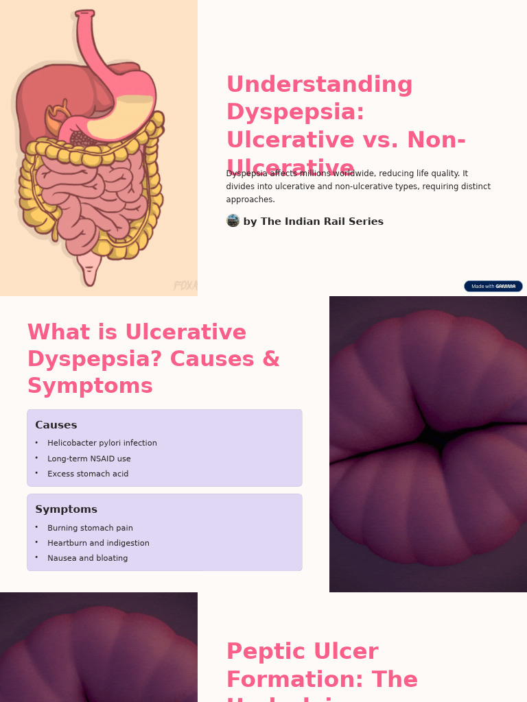 Understanding Dyspepsia Ulcerative Vs Non Ulcerative | PDF | Indigestion | Symptoms And Signs
