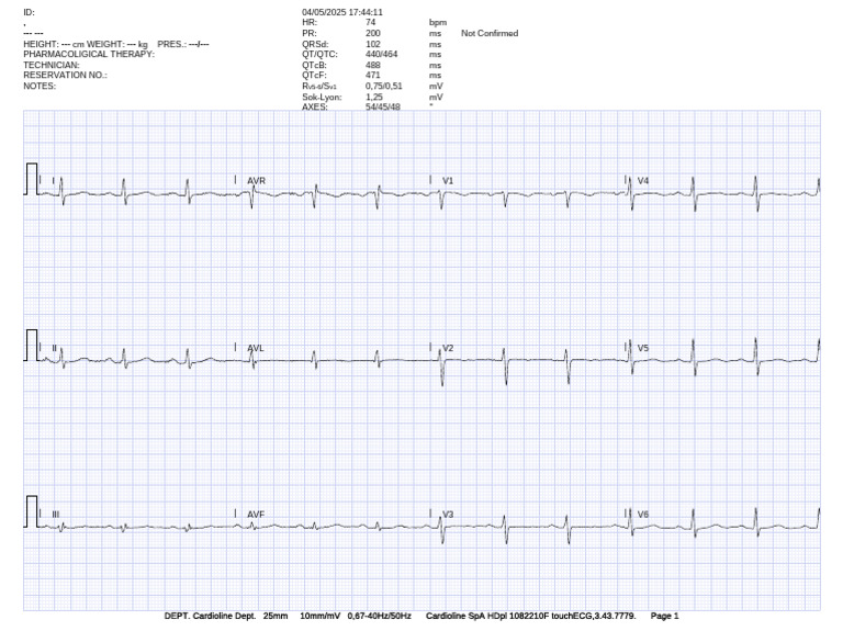 ECG Report Summary and Analysis | PDF