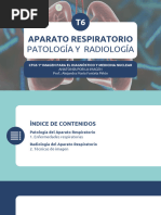 Radiografía de Tórax Normal - Patrón Intersticial | PDF | Pulmón | Tórax