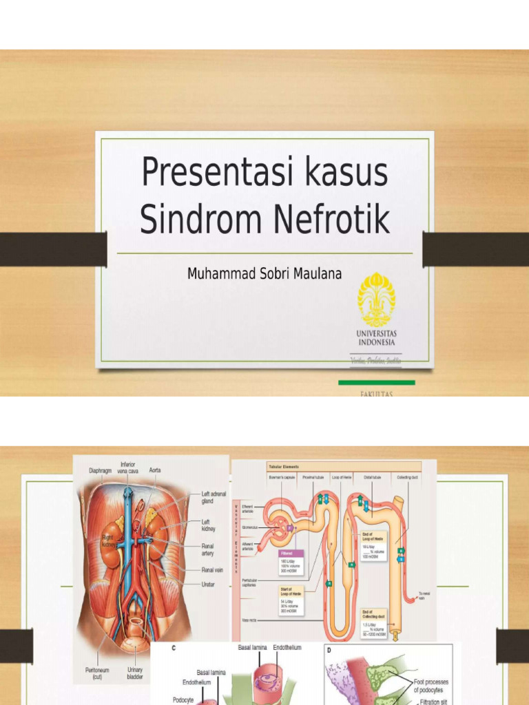 Lapkas Sindrom Nefrotik | PDF