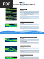 OCT Interpretation for Macula Diseases | PDF | Visual System | Diseases ...