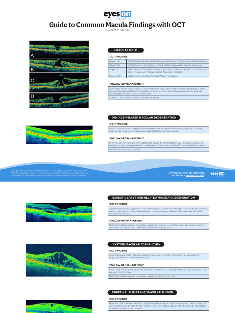 Guide to Common Macula Findings with OCT_Cheat-Sheet | PDF ...