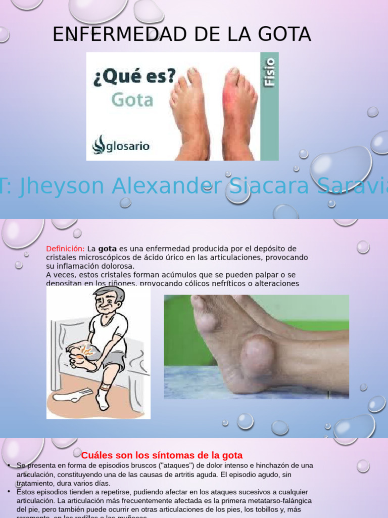 Enfermedad de La Gota | PDF | Gota | Enfermedades y trastornos