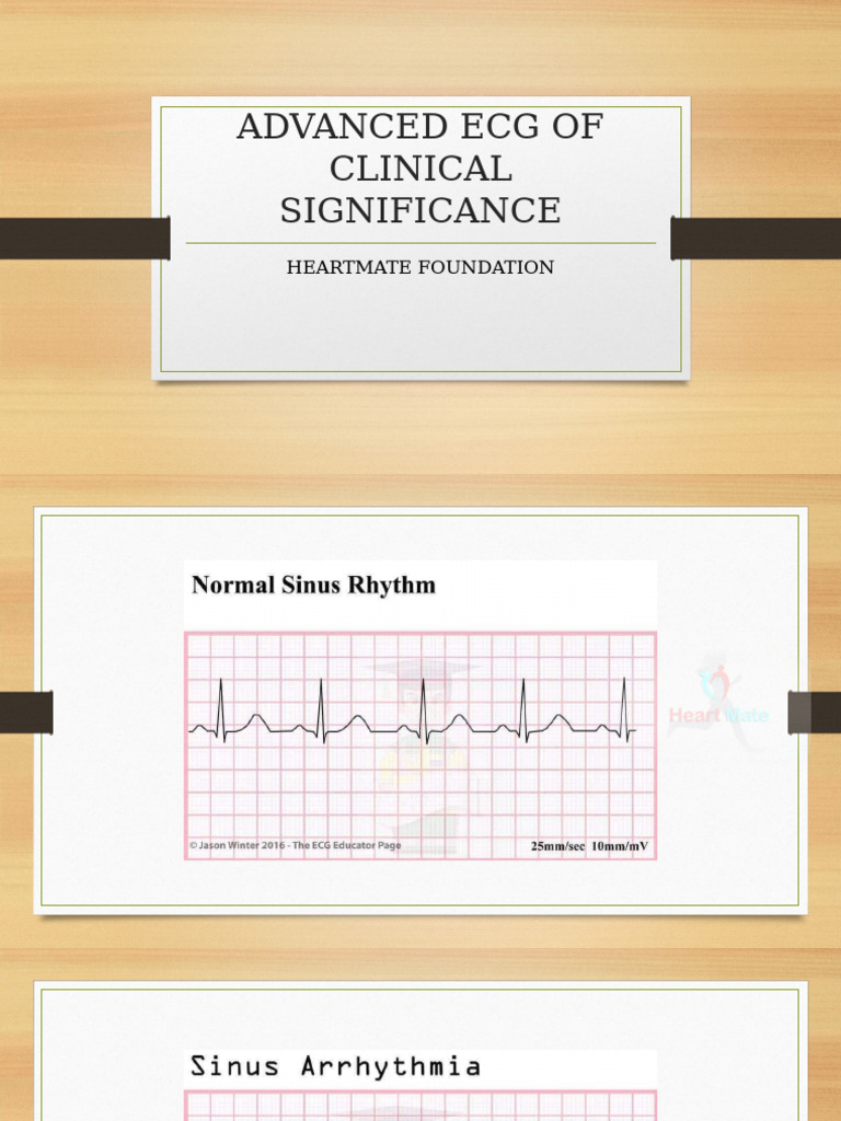 Ecg Practice 2 | PDF