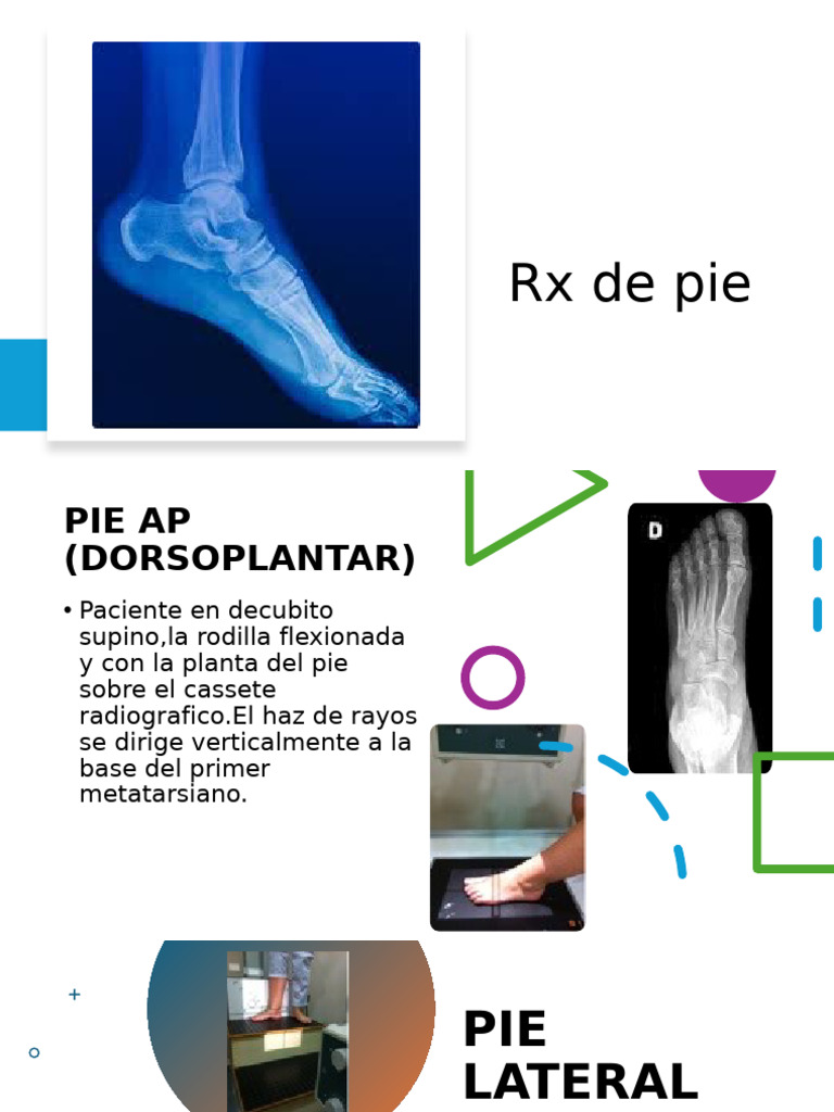 Radiografías del Pie: AP, Lateral y Oblicua | PDF | Pie | Extremidades ...