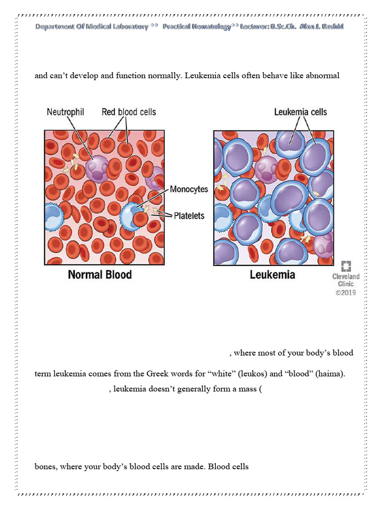 Understanding Leukemia: Types & Causes | PDF | Leukemia | White Blood Cell