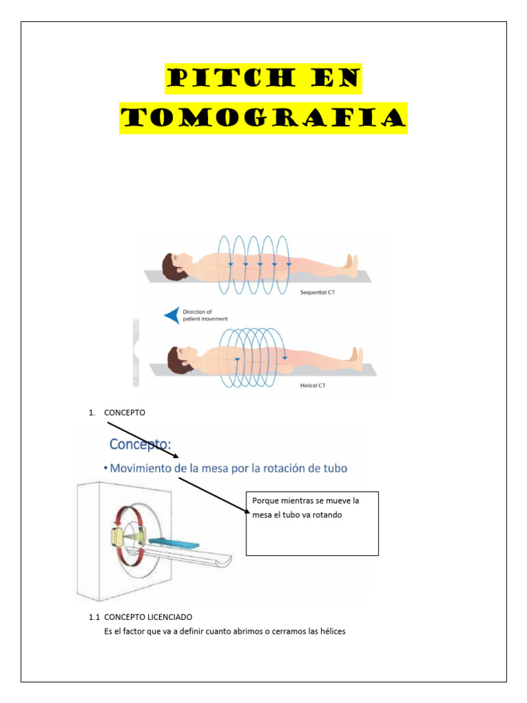 Factor Pitch en Tomografía Computarizada | PDF | Ct Scan