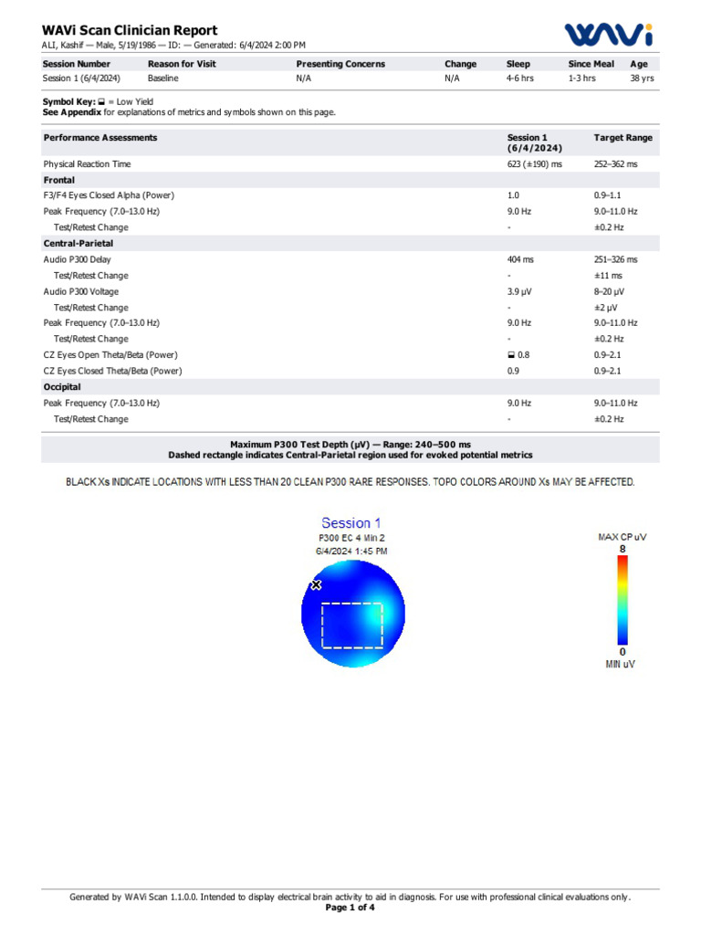 WAVi Brain Scan Results Report | PDF | Electroencephalography ...