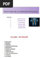 Fractures diaphysaires du fémur : traitement | PDF | Maladies et ...