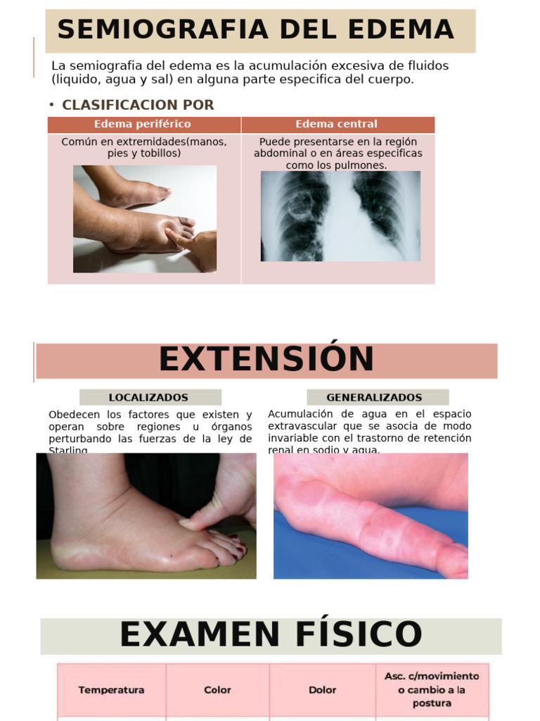 Semiografia Del Edema_045258 | PDF