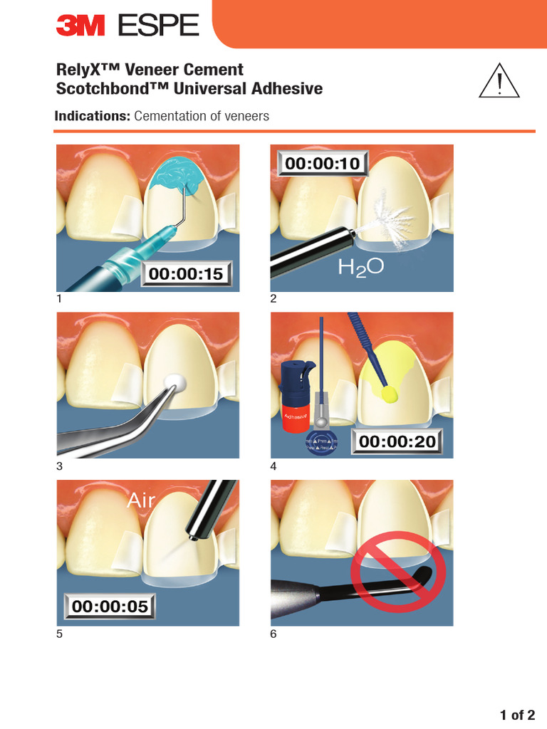 RelyX Veneer Cementation of Veneers | PDF