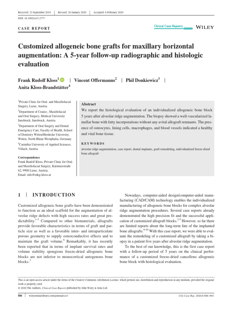 Customized Allogeneic Bone Grafts For Maxillary Horizontal | PDF ...