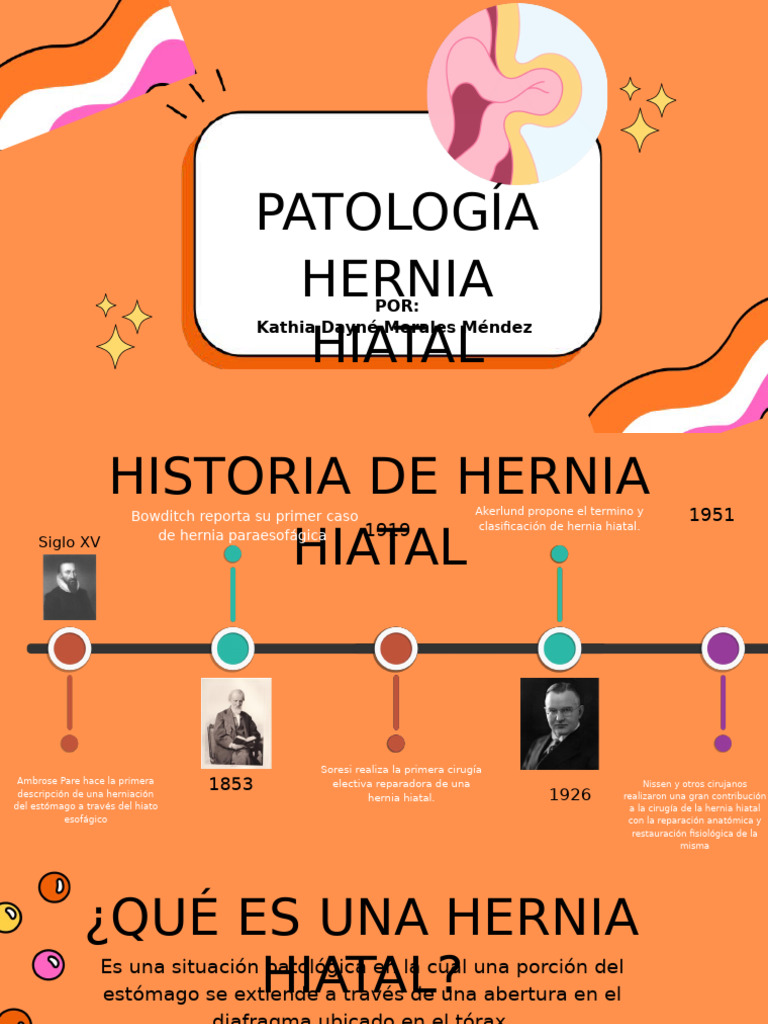 Presentacion Hernia Hiatal | PDF | Enfermedades y trastornos | Gastroenterología