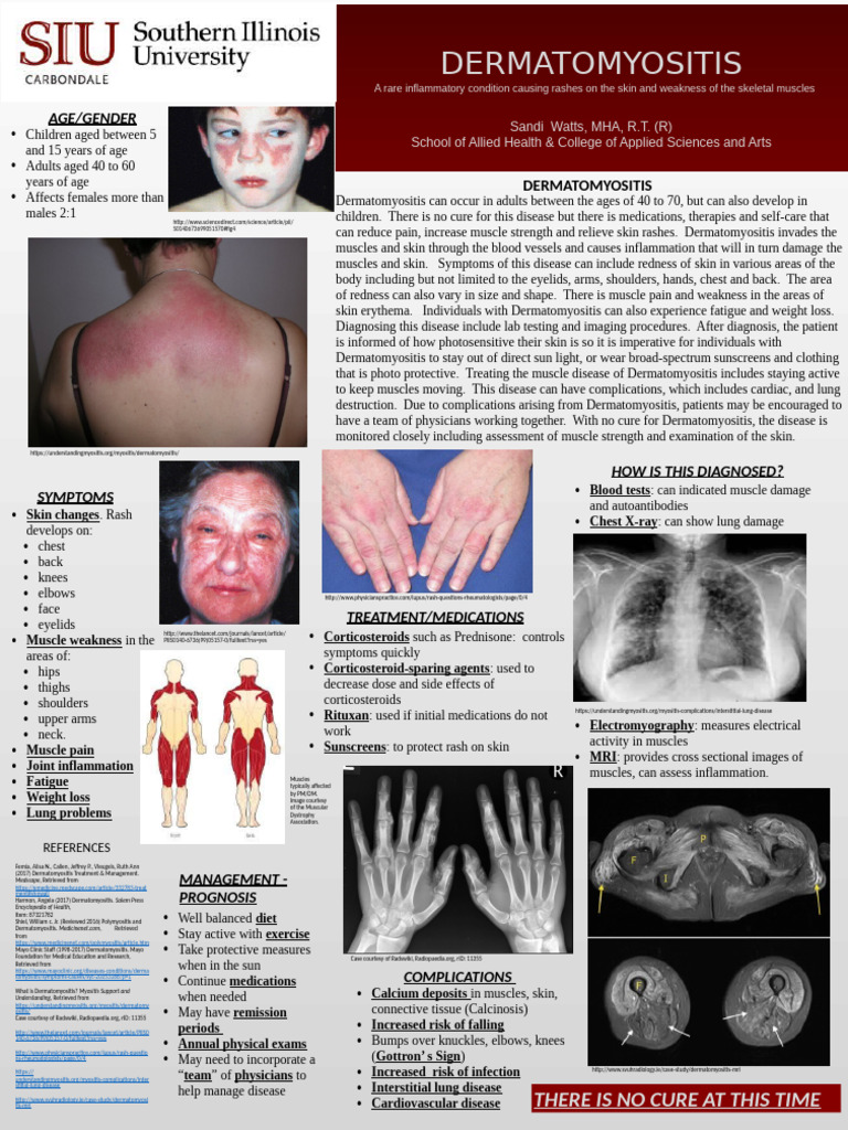 Watts Poster Oct2017 | PDF | Diseases And Disorders | Medical Specialties