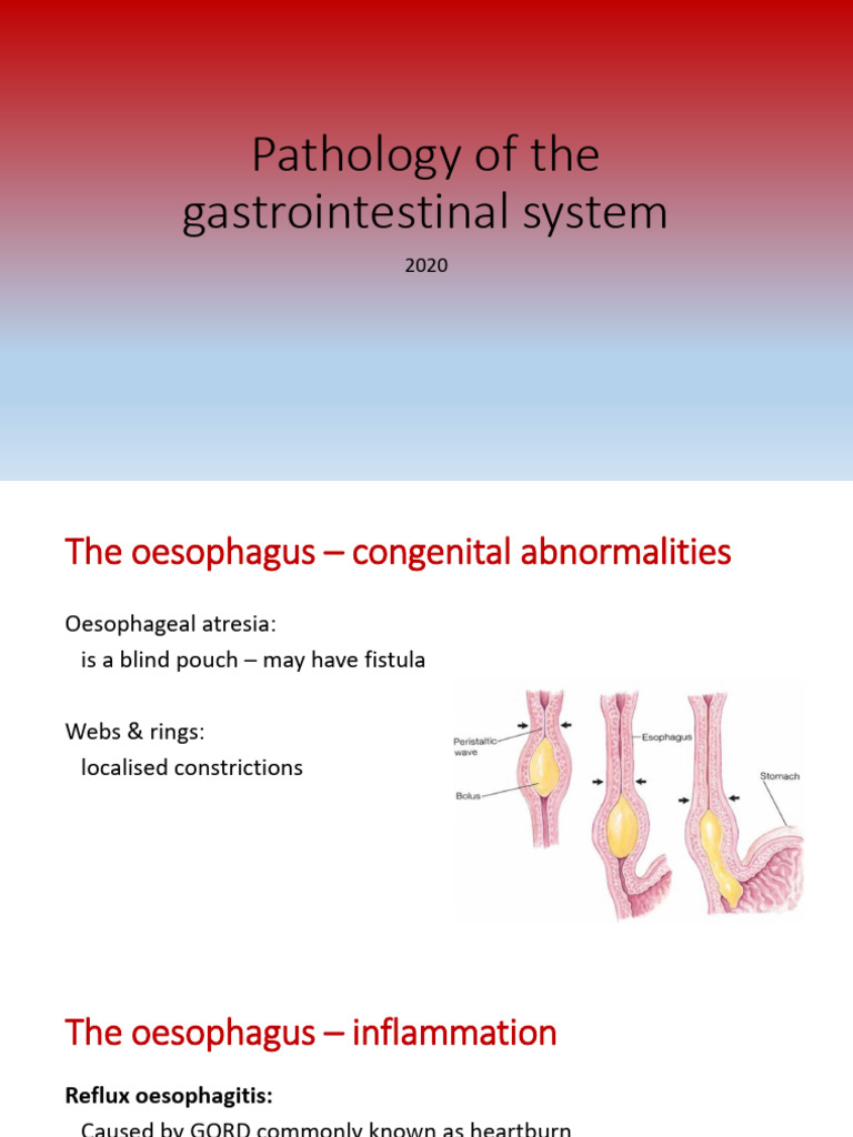6 Pathology of The Gastrointestinal System | PDF | Cirrhosis | Esophagus