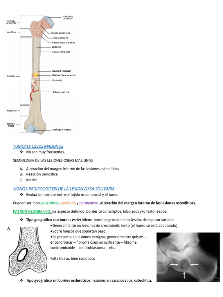 yo TUMORES OSEOS MALIGNOS | PDF | Hueso | Neoplasias
