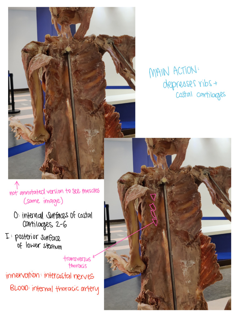 Thorax Annotated (Medical Museum) | PDF | Thorax | Thorax (Human Anatomy)
