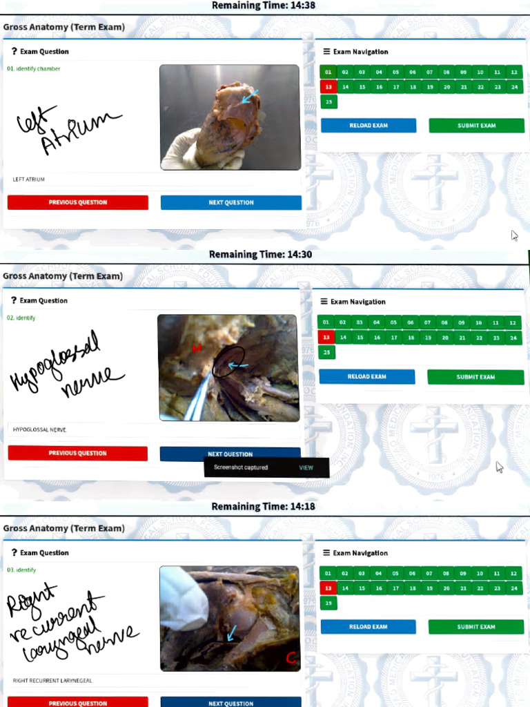 Mediastinal Structures 2 Lab | PDF