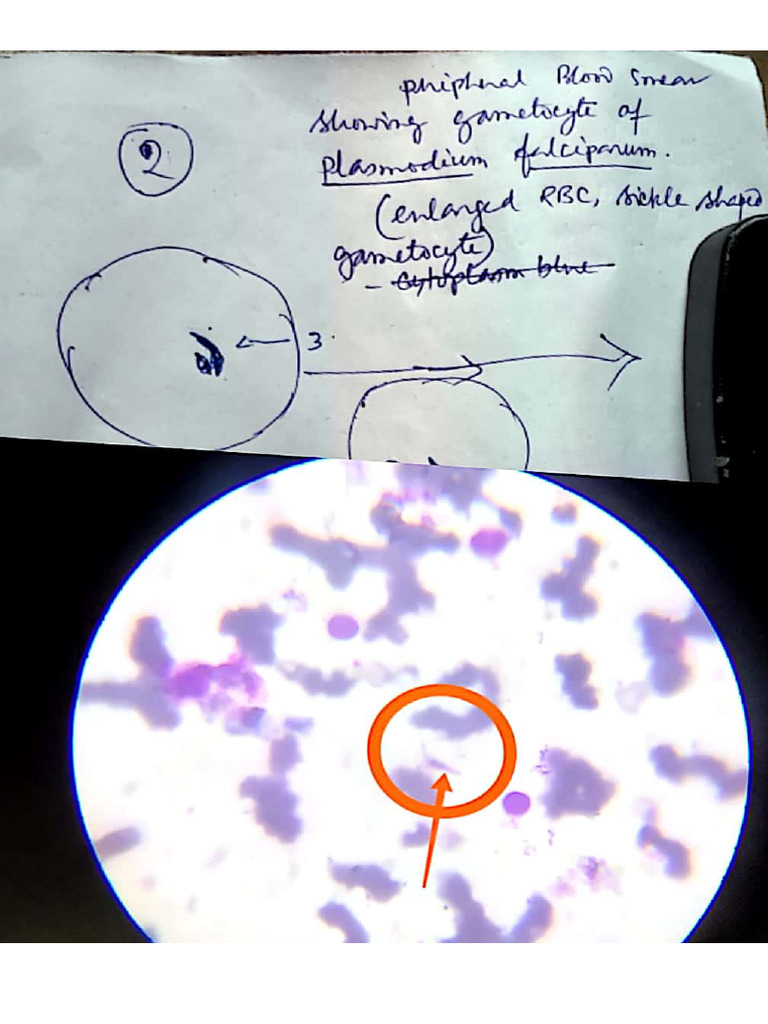 Micro Spotting | PDF