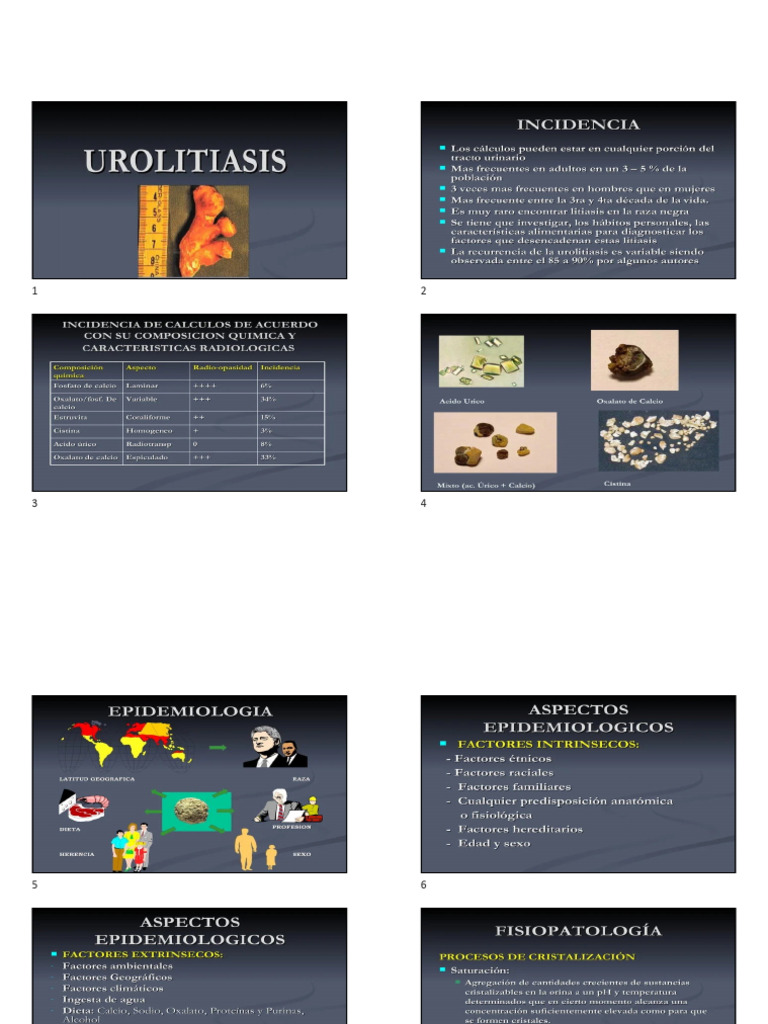 Urolitiasis | PDF
