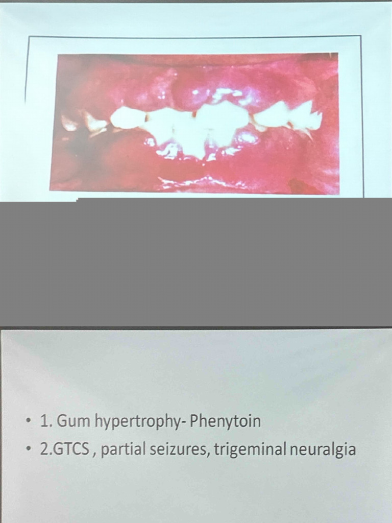 pharma spotting | PDF