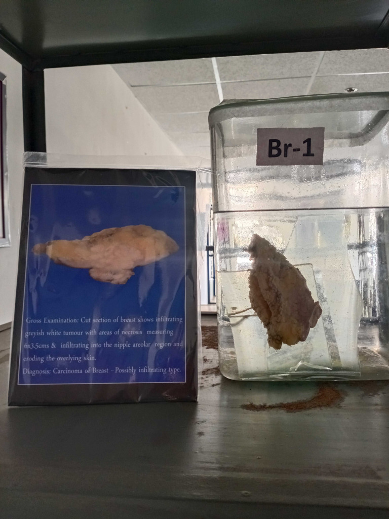 Patho Specimen | PDF