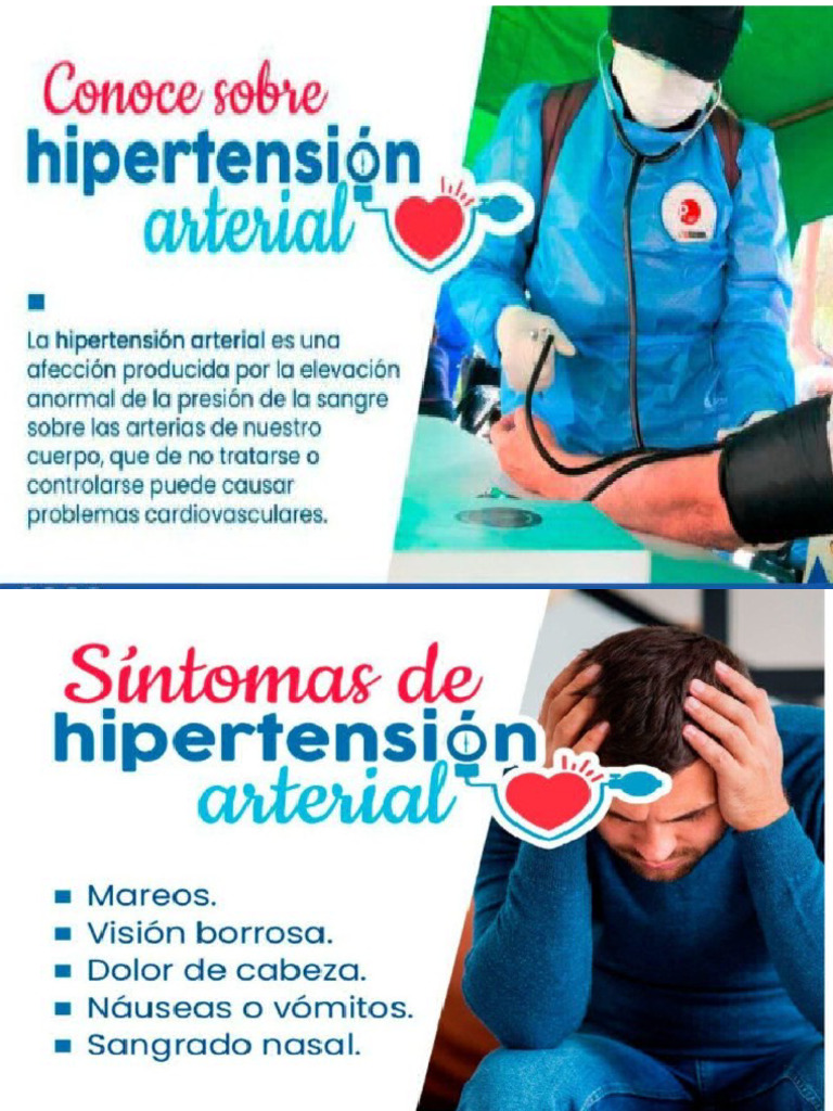 Hta Imprimir | PDF