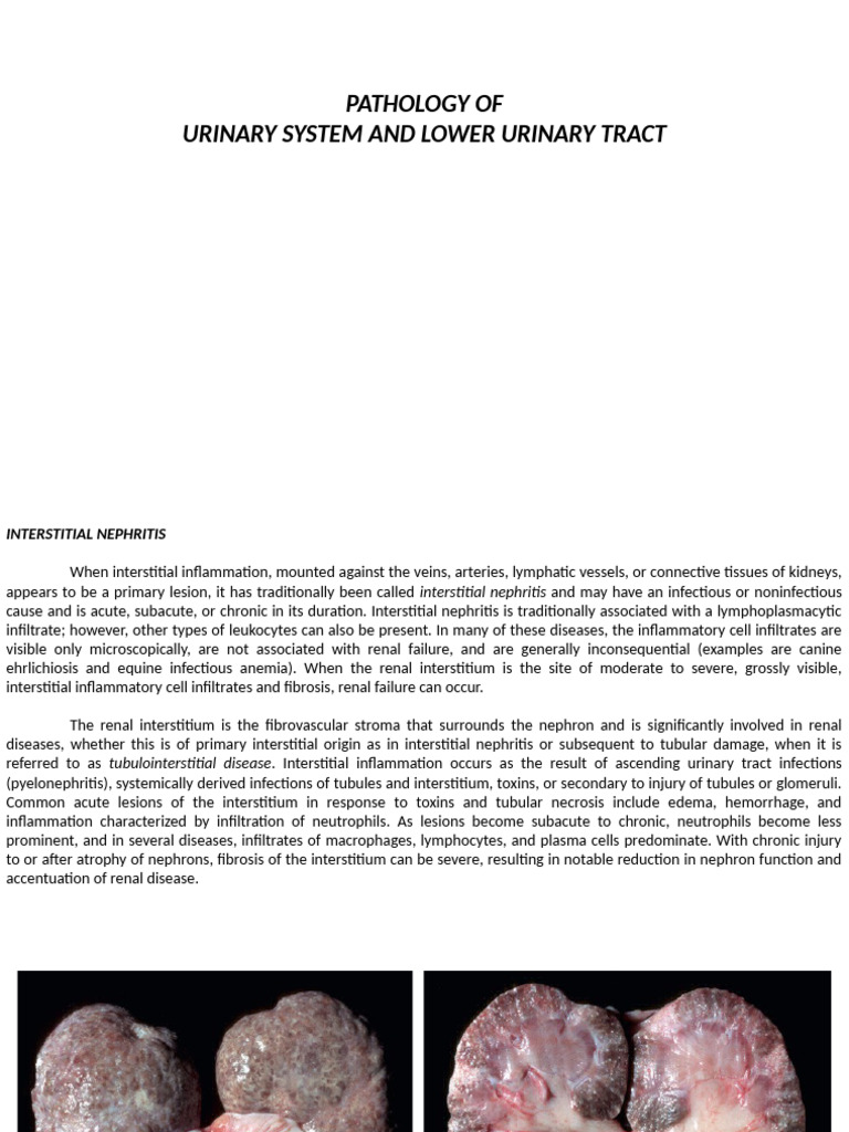 12 Pathology of Urinary System and Lower Urinary Tract | PDF | Urinary ...