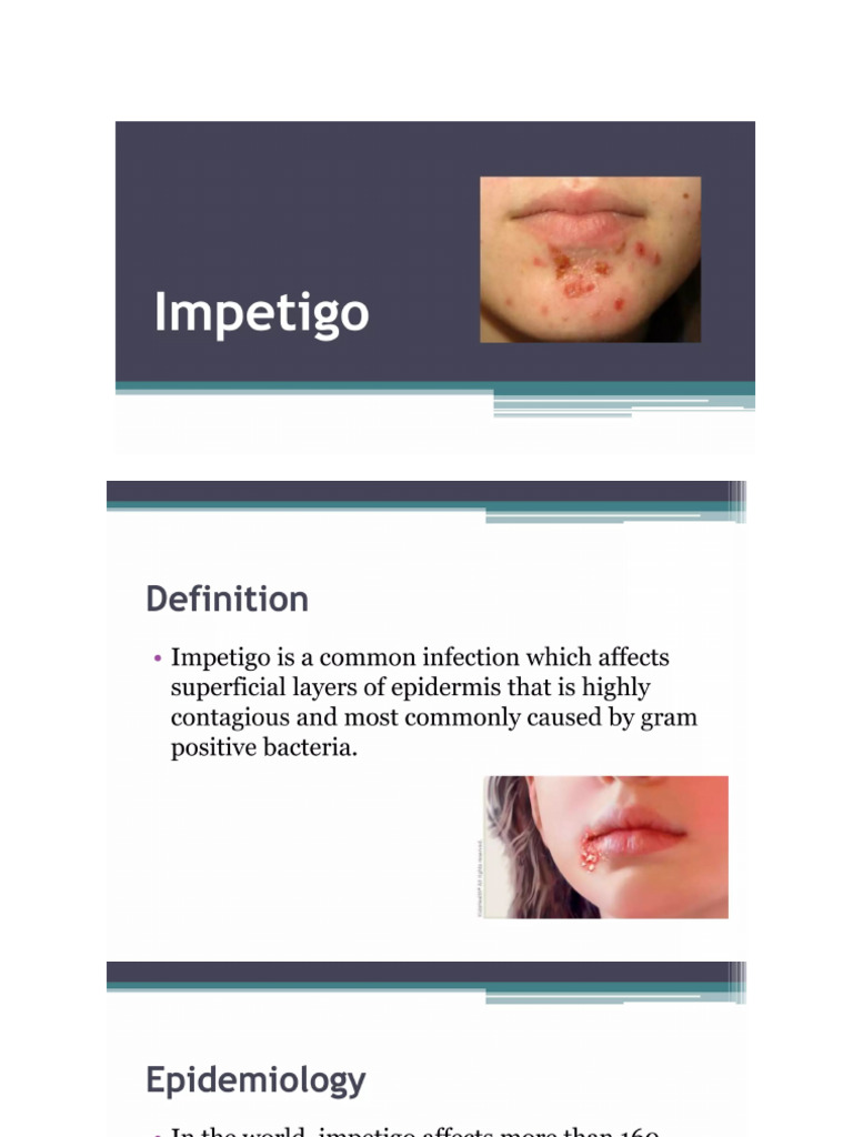 Impetigo Medical Surgical Nursing PDF | PDF