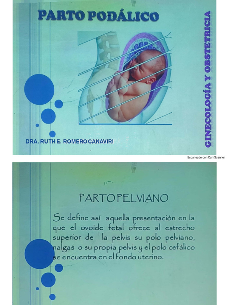 Parto Podalico - Ginecología | PDF