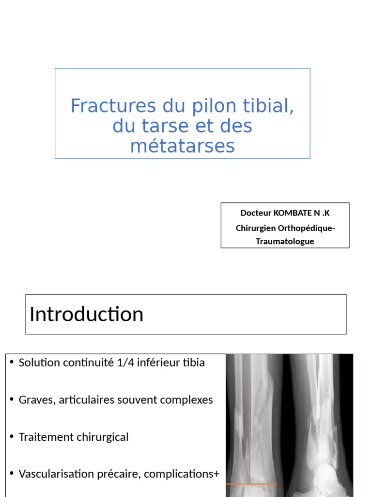 Fracture du pilon tibial, des os du tarse et métatarsiens | PDF | Pied ...