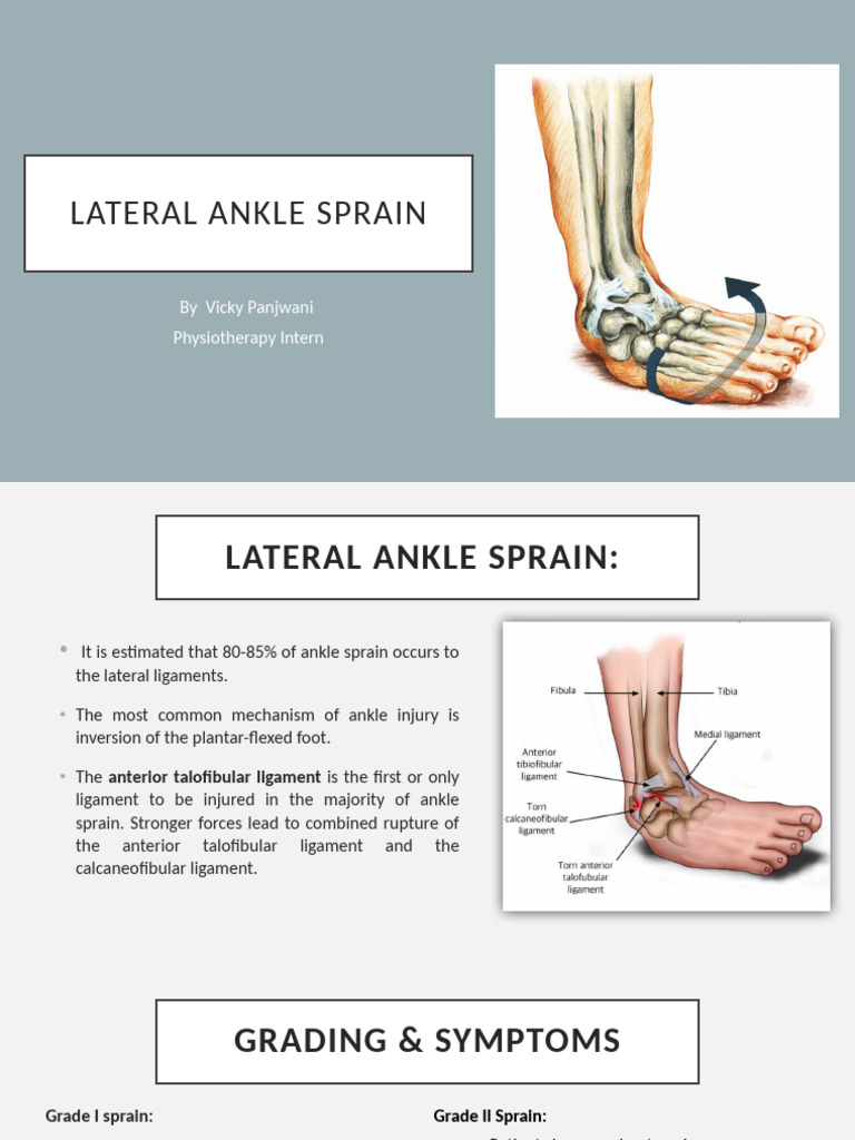 Lateral Ankle Sprain | PDF | Ankle | Musculoskeletal System