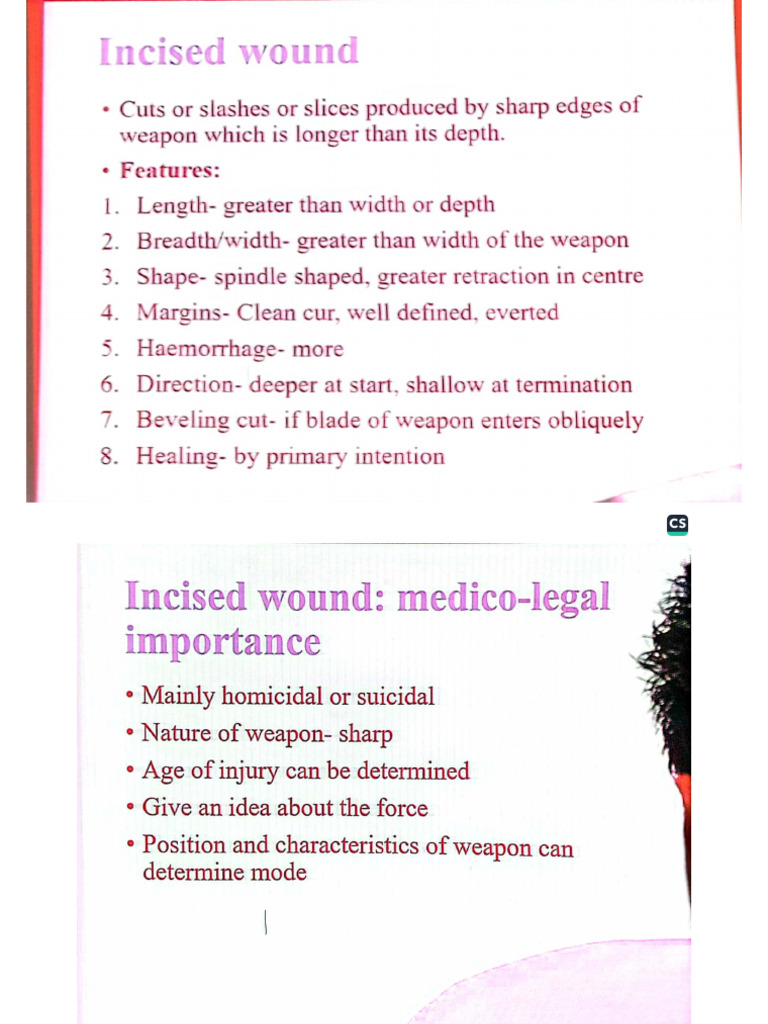 Wound | PDF