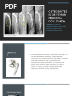 Técnica Quirúrgica Placa Philos: Conceptos | PDF | Tornillo | Metalurgia