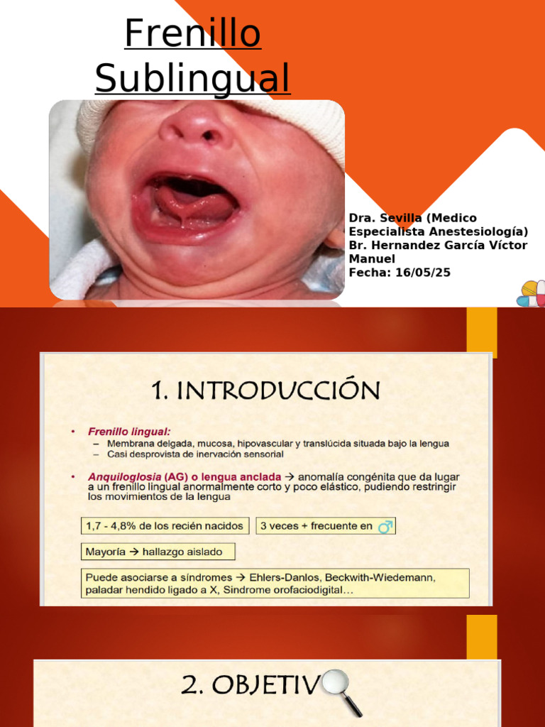 Frenillo Sublingual ORL | PDF