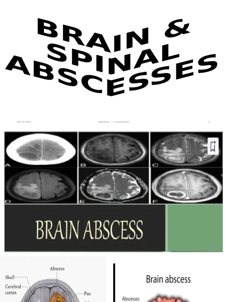 Brain and Spinal Cord Abscess | PDF | Medicine | Diseases And Disorders