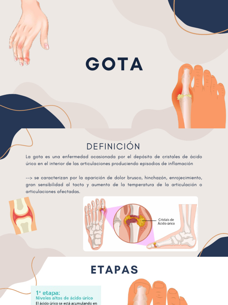 GOTA | PDF | Gota | Medicina