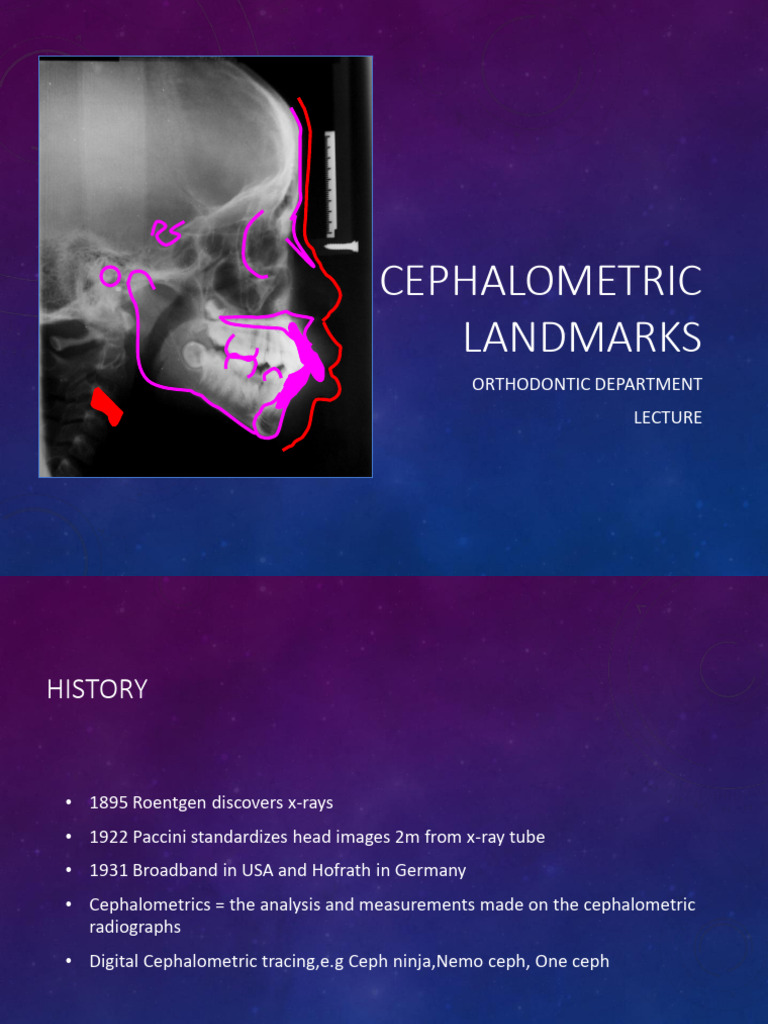 Ceph Landmarks Presentation | PDF | Dentistry Branches