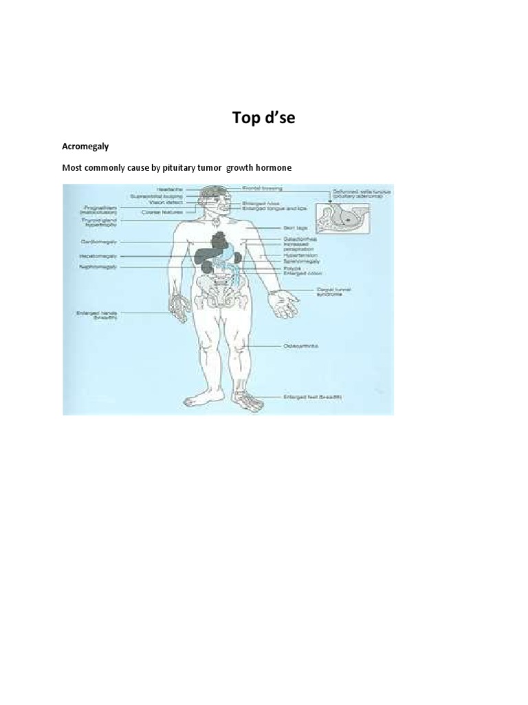 Acromegaly | PDF | Growth Hormone | Glands