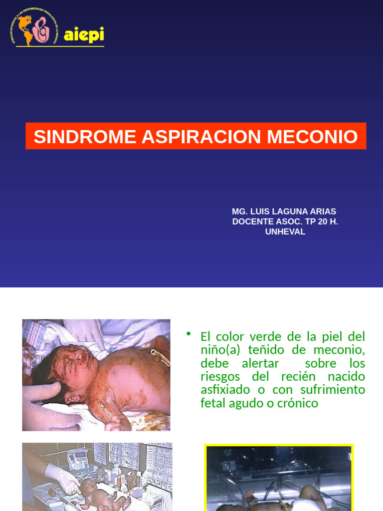 Sindrome Aspiracion Meconio | PDF | Feto | Especialidades Medicas