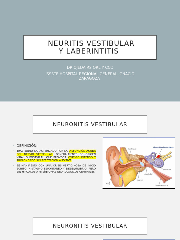 Neuritis y Laberintitis | PDF | Vértigo | Enfermedades y trastornos