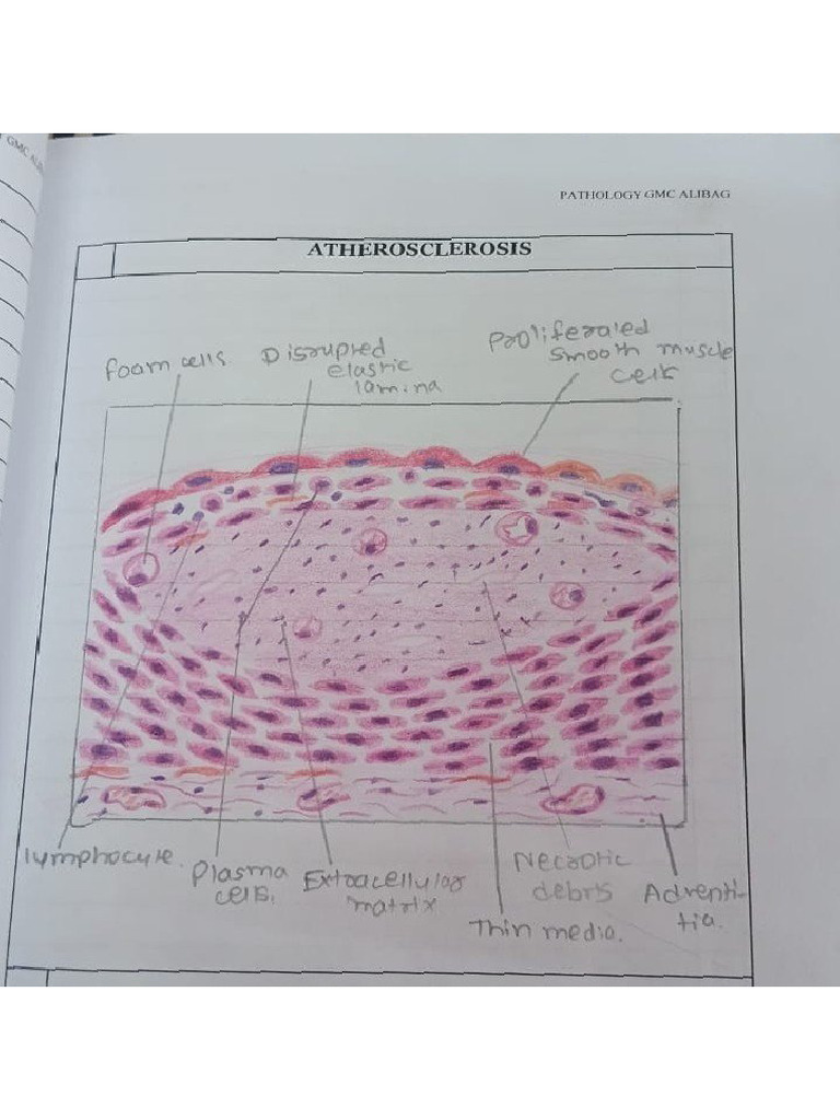 ?Pathology Diagram ? | PDF