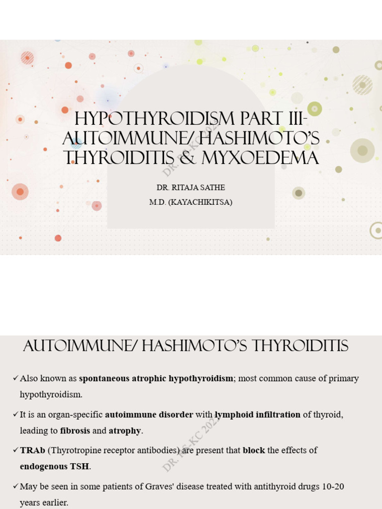03 - Hypothyroidism Part-3 | PDF | Hypothyroidism | Thyroid