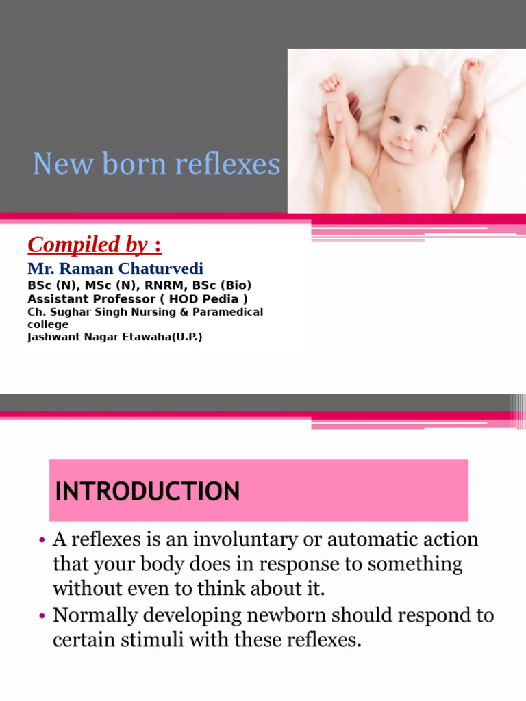 Newborn Reflex | PDF